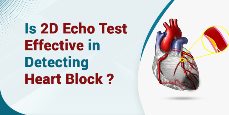 Is 2D Echo Test Effective in Detecting Heart Blockages ...